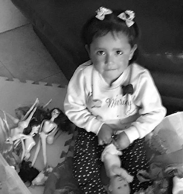 Sayuri – Malformations of the fingers – Congenital amputation of the ...